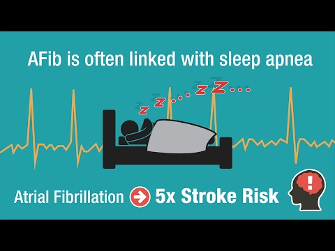 Atrial Fibrillation Litfl Life In The Fast Lane Medical