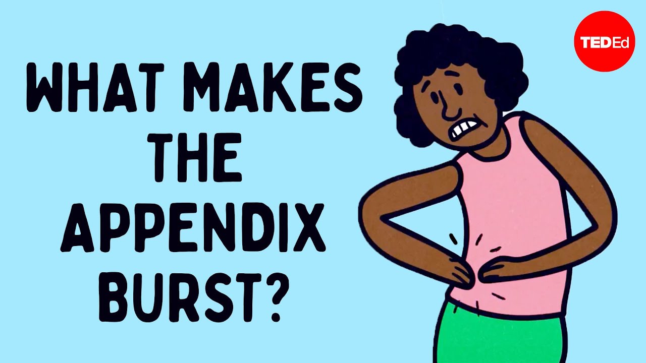 What does appendix pain feel like - David R. Flum