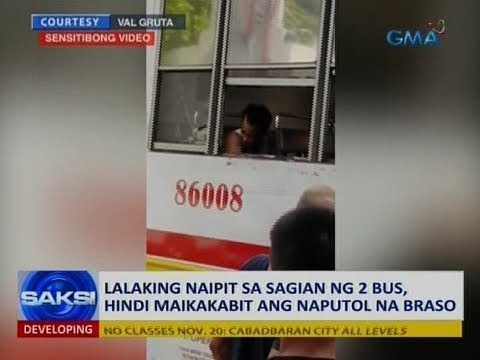 Lalaking naipit sa sagian ng 2 bus, hindi maikakabit ang naputol na ...