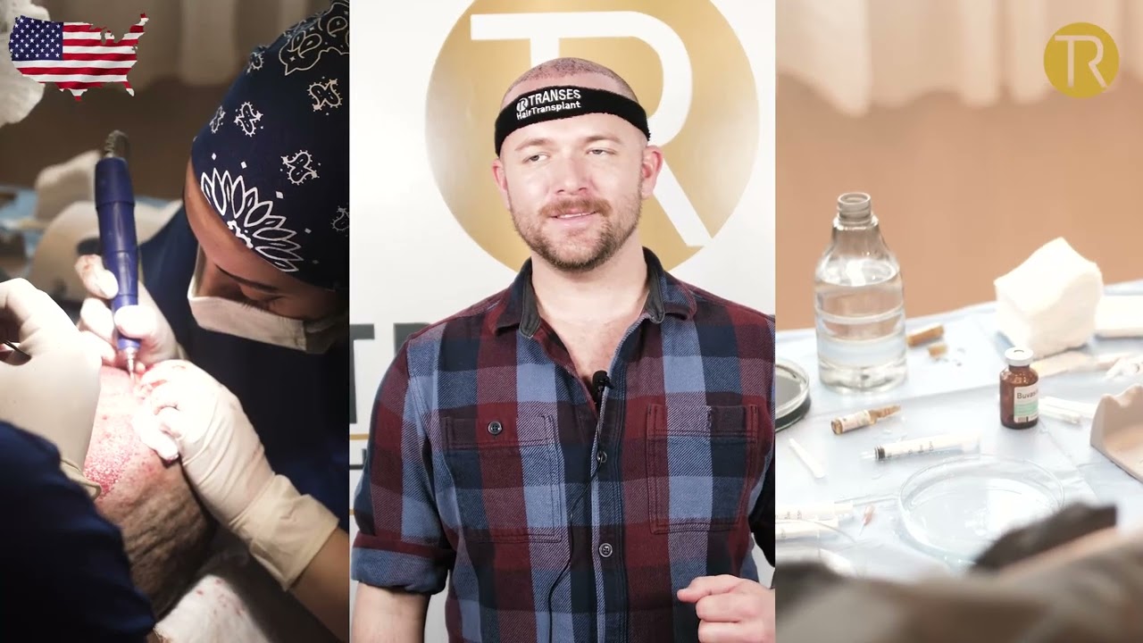 Other Videos - Transes Hair Transplant