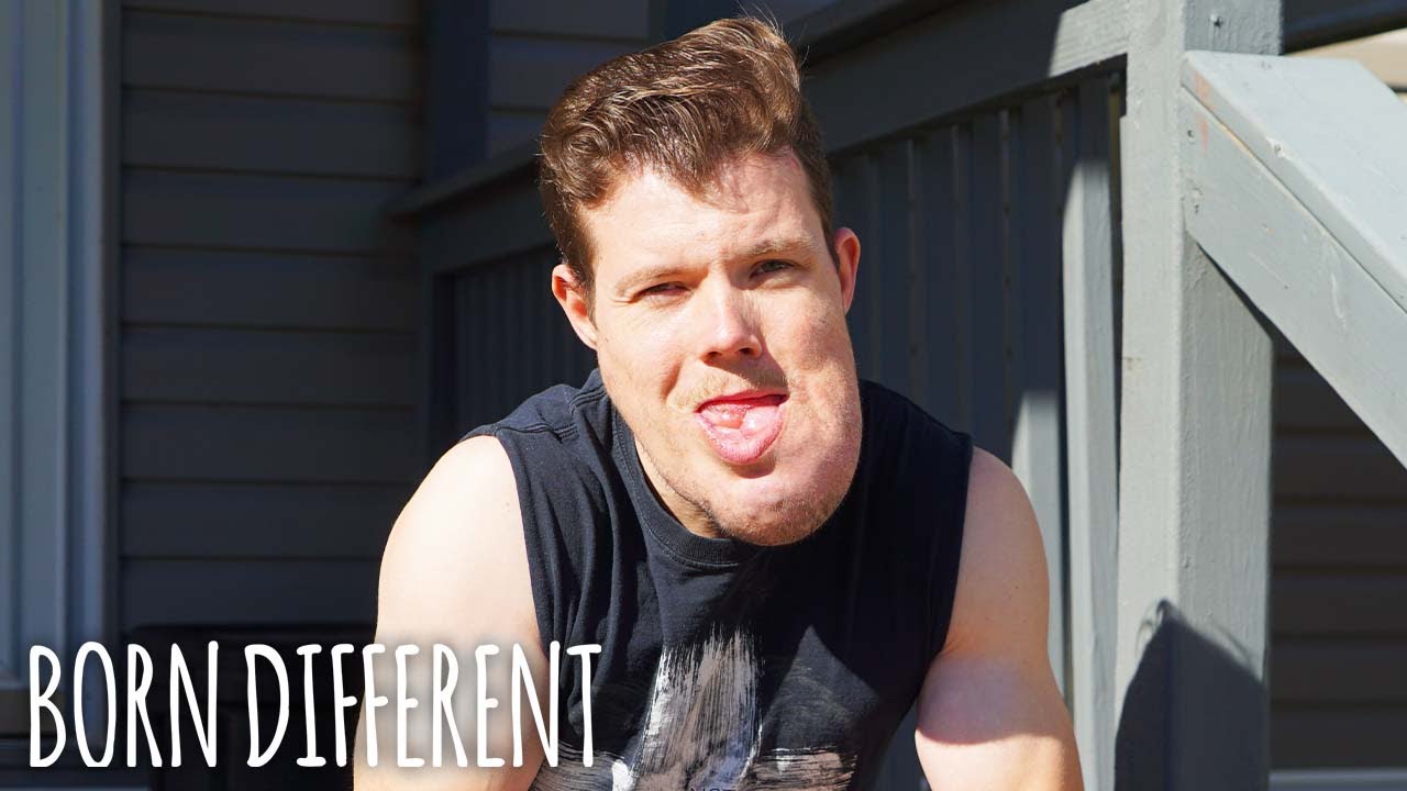 I had to choose between my voice and my face - born different