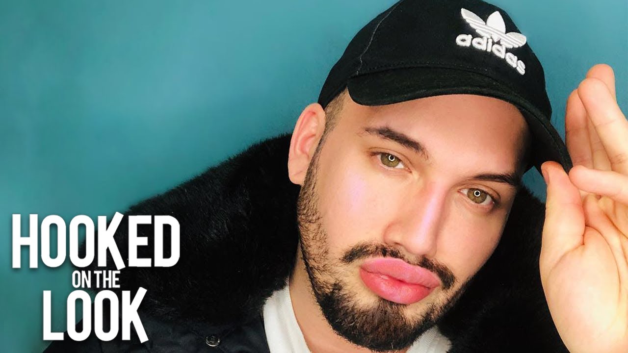 I inject my own face to look plastic - hooked on the look