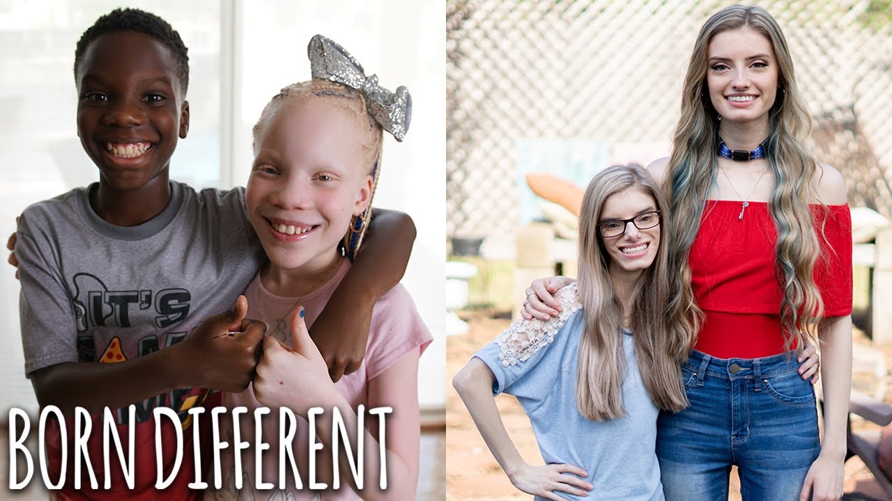 We're twins but different - born different