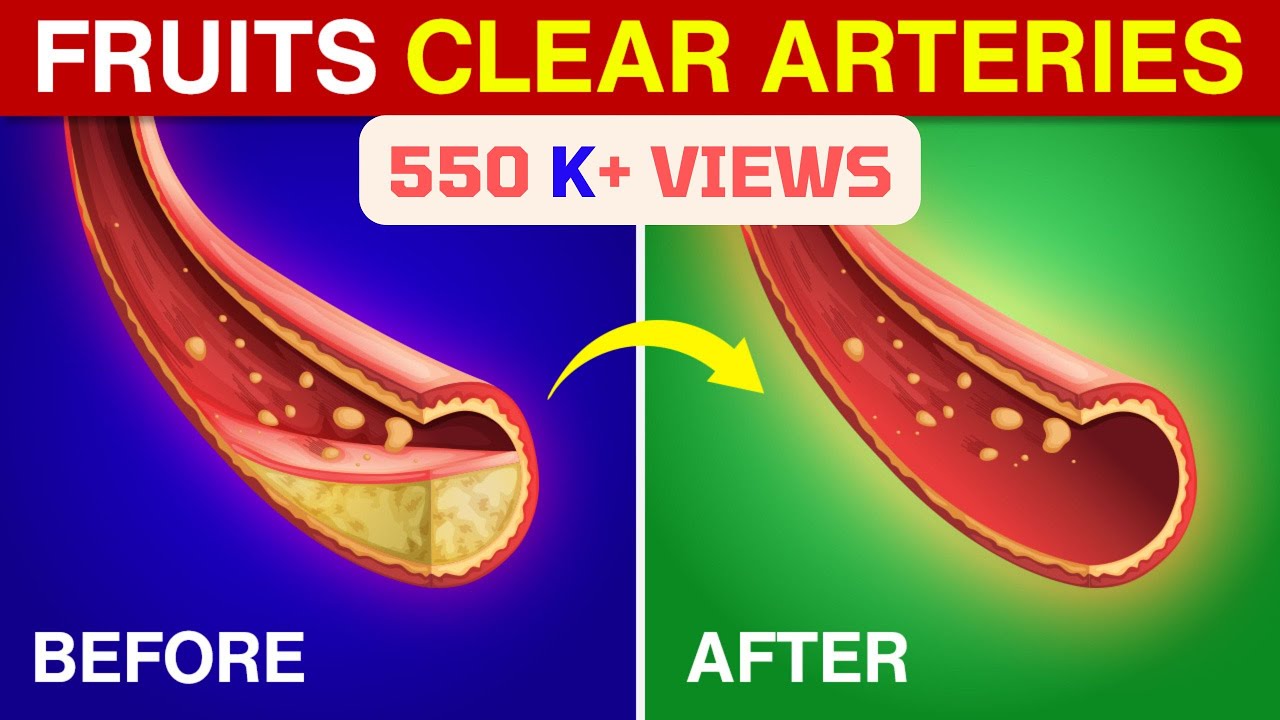 A Comprehensive Guide to Understanding Dialysis Fistulas