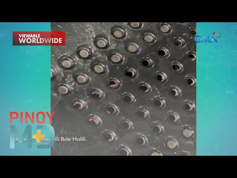Bed bugs o surot, paano nga ba mapupuksa? | Pinoy MD | Videos | GMA News Online