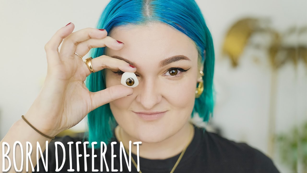 My skin caused me to lose an eye - born different
