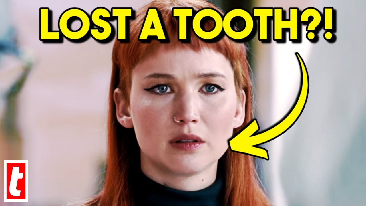 15 Actors Who Broke Their Teeth For A Role